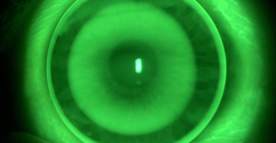 Conóptica crece en torno a un 50% en el segmento de la Orto-k - Revista ...