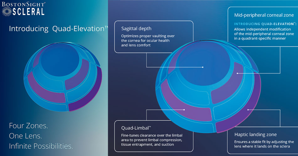 Conóptica incorpora Quad-Elevation™ a la lente BostonSight SCLERAL ...